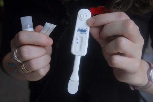 Chẩn đoán HIV nhanh sau 20 phút